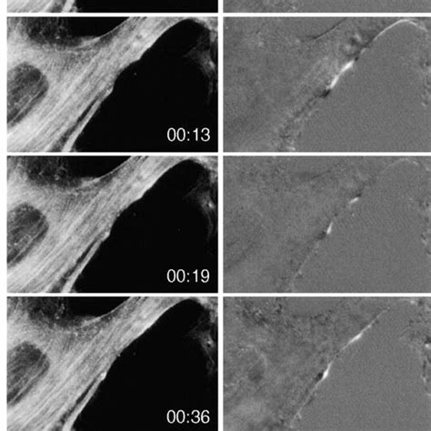 Short And Long Term Behavior Of Gfpγ Actintransfected Cell Whose