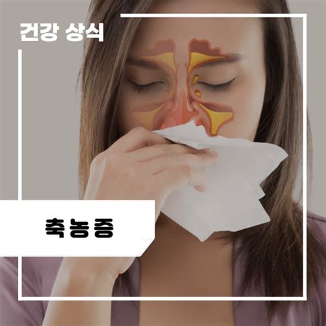 축농증 부비동염 증상 및 원인 치료 약 전염 두통 기침 열 네이버 블로그