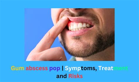 Gum Abscess Pop Symptoms Treatment And Risks Cmh Healths