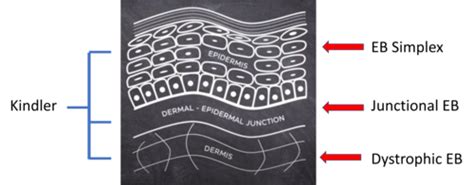 Genodermatoses Flashcards Quizlet
