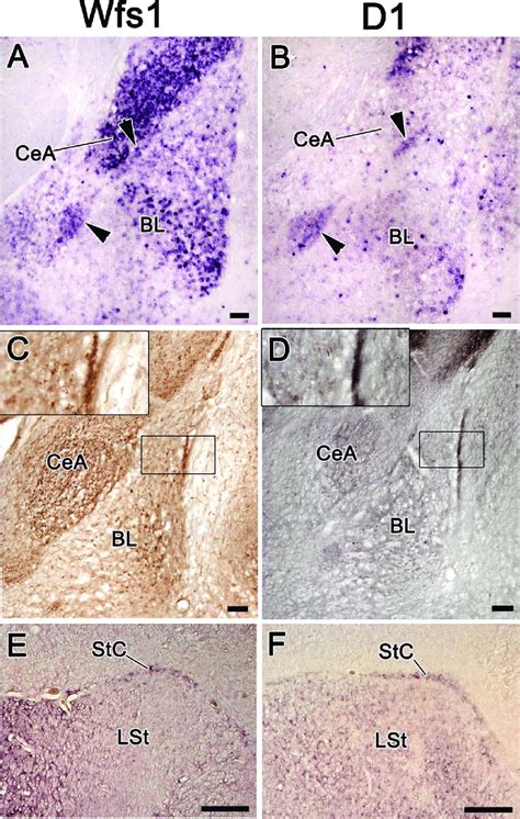 The Expression Of Wfs1 And Drd1a In The Mouse Intercalated Amygdala And