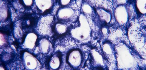 Elastic Cartilage Tissue Microscopic Views Of The Three Forms Of