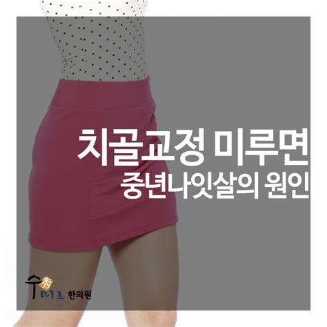 돌출된 치골교정 미루면 중년나잇살의 원인√ 네이버 블로그
