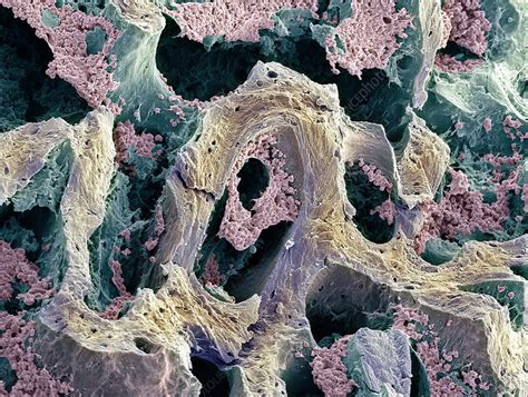 Bone Marrow Sem Stock Image P2340072 Science Photo Library