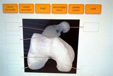 Solved Identify The Anatomical Structures Shown In The Inferior View