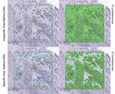 Immunohistochemical Detection Of Cd1a Dendritic Cells In An