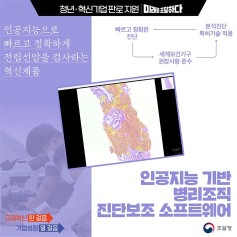 대한민국 조달청 인공지능으로 전립선암 검사 빠르고 정확하게 혁신제품 ‘인공지능 기반 병리조직