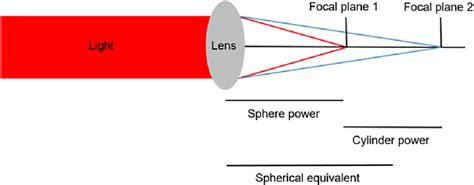 Figure 1 From Corneal Endothelial Morphology And Ocular Biometric