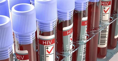 What Is The Difference Between AIDS And HIV
