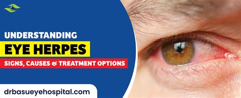 Herpes Eye Infection