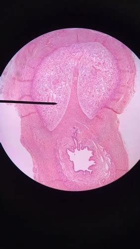 Reproductive Exam AP Lab Flashcards Quizlet