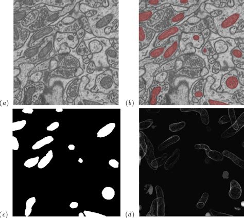 Figure 1 From Fast Mitochondria Detection For Connectomics Semantic Scholar