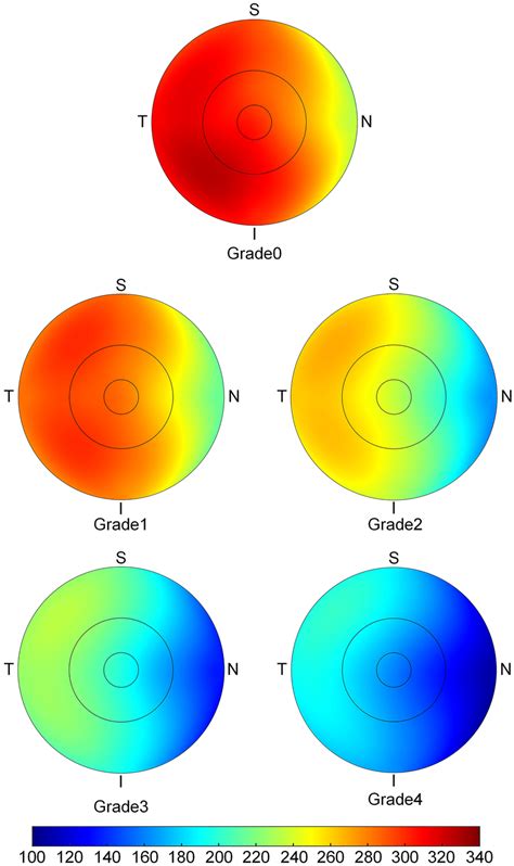 the topographic characteristics of choroidal layer thickness in etdrs