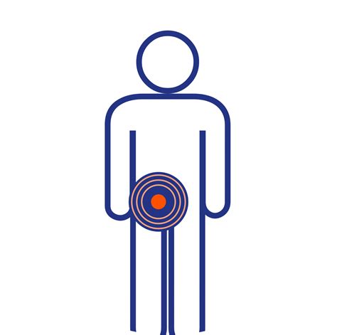 Inguinal Hernia National Hernia Institute