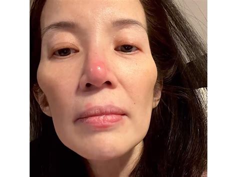 Kris Aquino Gains Weight Netizens Pray For Her Recovery Gma Entertainment