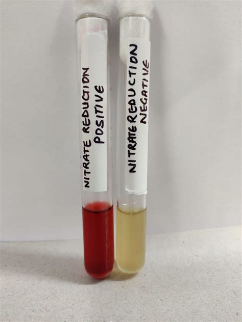 Lactobacillus Spp Biochemical Test