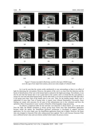 Smartphone Aided Real Time Blood Vein Detection System PDF Blood