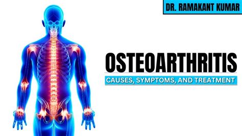 Osteoarthritis Causes Symptoms And Treatment
