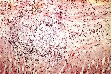 Haematoxylin And Eosin Stain High Power View Of The Myenteric Plexus Download Scientific