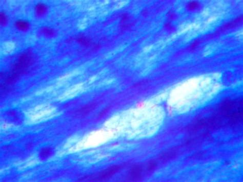 Afb Microscopy And Quality Assurance Copy Ppt