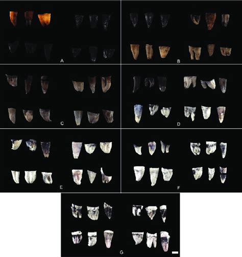 1 Example Of Root Surface Colour Alterations After Exposure To Various
