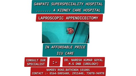 Laproscopic Appendicectomy Appendix Youtube