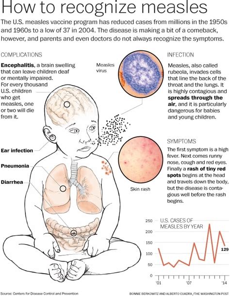 U S Measles Outbreak Sets Record For Post Elimination Era The