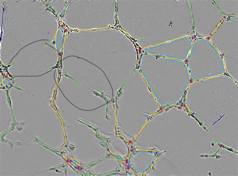 How To Improve Sensitivity Of Angiogenesis Analyzer In Imagej