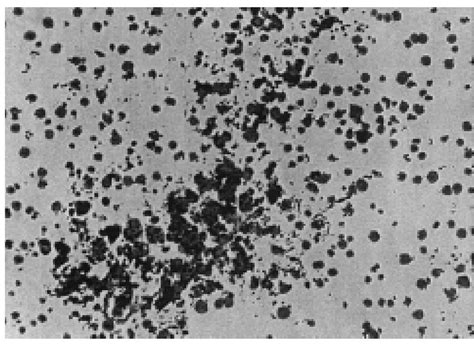 Ductile Iron Microstructure With A Dross Type Defect This