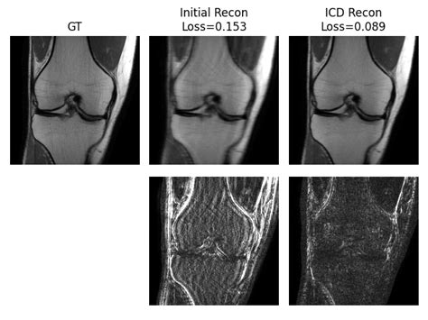 Github Sidgautam95 Adaptive Sampling Mri Suno Code For Reproducing Suno Paper