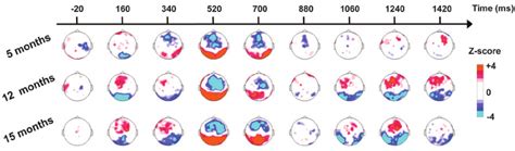 Event Related Potentials As A Function Of Age Over Time 2d Scalp Download Scientific Diagram