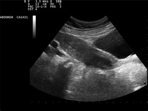 Uterine Malformations Benign And Malignant Uterine Pathology Visuals