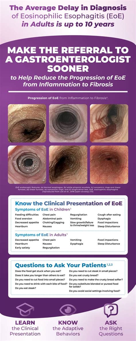 Eosinophilic Esophagitis Primary Care Toolkit Gastro Girl