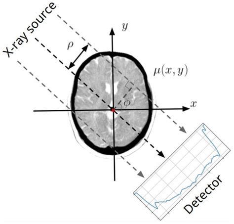Tomographic Reconstruction General Approach To Fast Back Projection Algorithms
