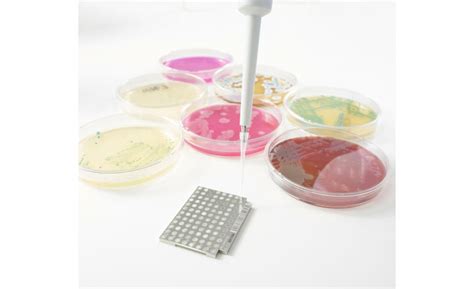 Rapid Microorganism Identification With Maldi Biotyper