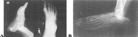 Identification Of Sex Depending On Radiological Examination The
