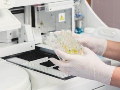 Demystifying Linearity Testing In Todays Clinical Laboratory Labcompare Com