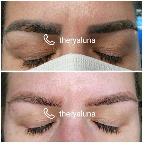 Hope For Botched Brows 🙌🙌🙌 R Microblading