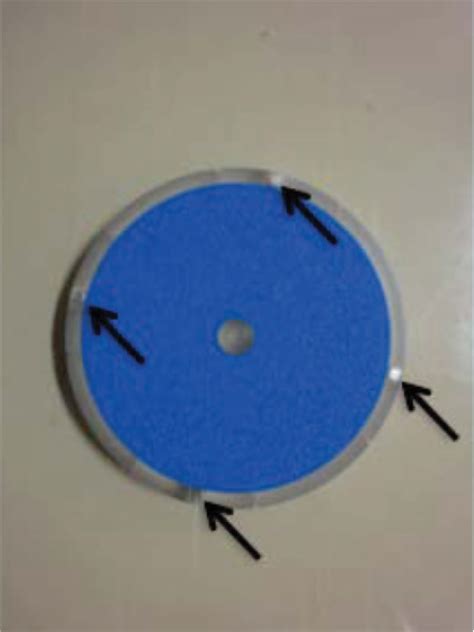 Figure 1 From An Isocenter Detection And Verification Device For Use In