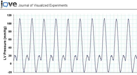 Representative Lv Pressure Waves From Labchart Pro Software Download