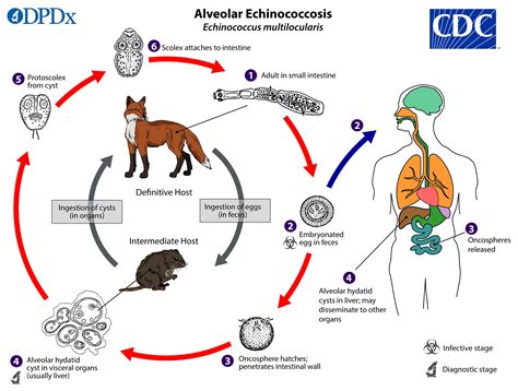 Echinococcus Echinococcosis Concise Medical Knowledge