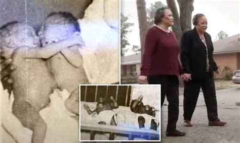 Our Story Is One Of Hope Conjoined Twins Who Made History As First Ever Pair Survive To