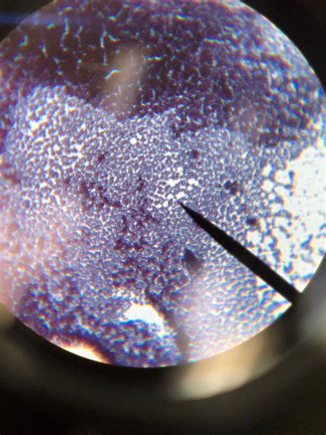 Enterococcus Faecalis Identification Experiment