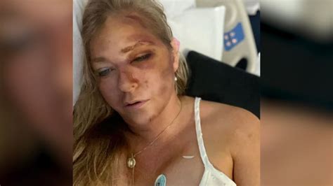 اتهمت جيفري إبستين باستغلالها جنسيًا رواية فيرجينيا جوفري بعد حادث