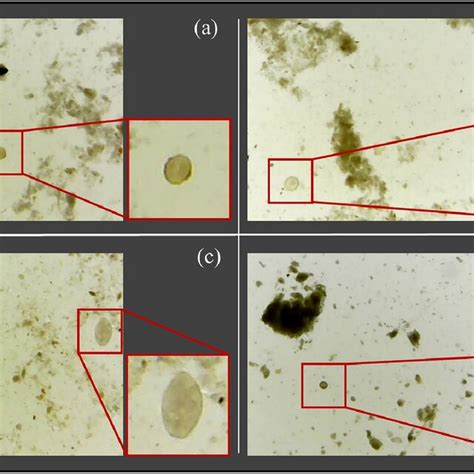 The Comparison Of Parasitic Egg Images From Left Good Quality Download Scientific Diagram