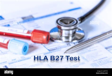 Hla B27 Test Testing Medical Concept Checkup List Medical Tests With Text And Stethoscope Stock
