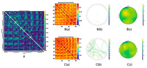 Sex Differences In Functional Connectivity Patterns During Mental
