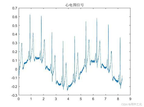【ecg心电信号】高通滤波器 带通滤波器心电信号qrs波检测（含自相关 噪声水平 信号水平 自适应阈值 心率）【含matlab源码 9951期