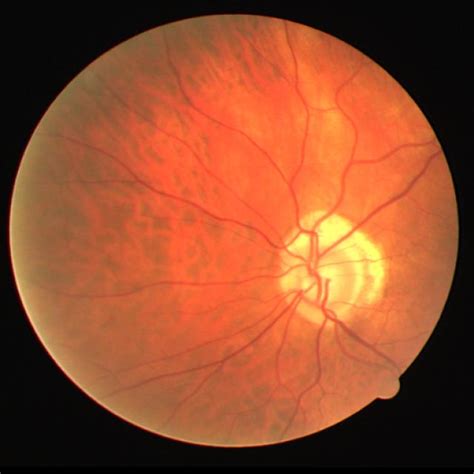 Retinal Vessel Segmentation Instance Segmentation Dataset And Pre Trained Model By Finalthesis