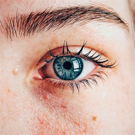 Enfermedades Oculares Y Su Prevención Marfil Oficial